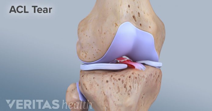 ACL: Jurrien Timber injury update